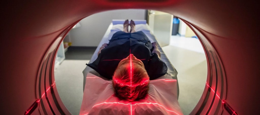 Brain MRI | I-MED Radiology Network