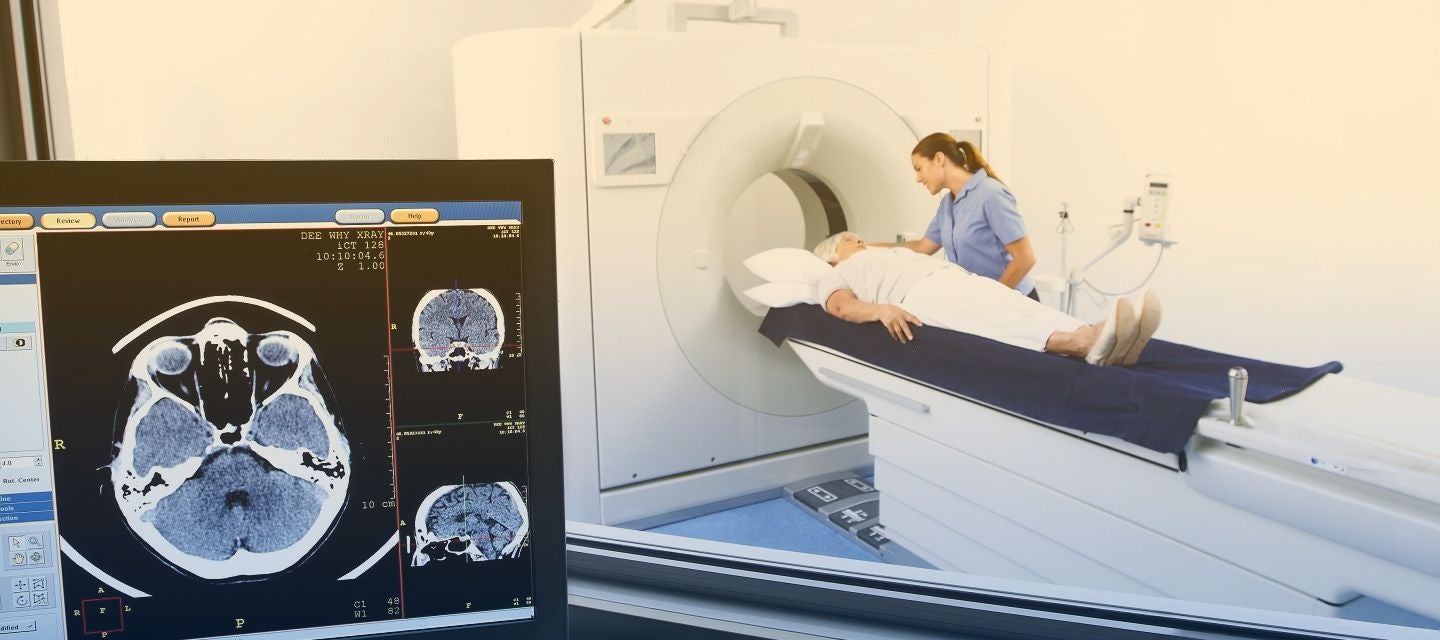How CT brain scans uncover neurological mysteries | I-MED Radiology Network