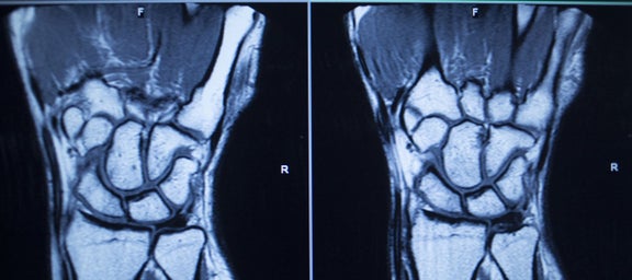 Hand and Wrist MRI | I-MED Radiology Network