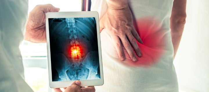 The most common causes of lower back pain | I-MED Radiology Network