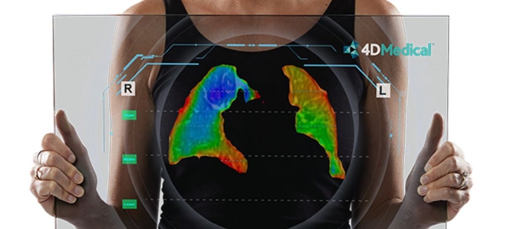 CT Lung Ventilation Analysis Software (CTLVAS) scan. | I-MED Radiology ...