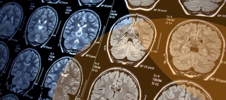 Q&A with Dr Jourena Li - MRI for GPs | I-MED Radiology Network