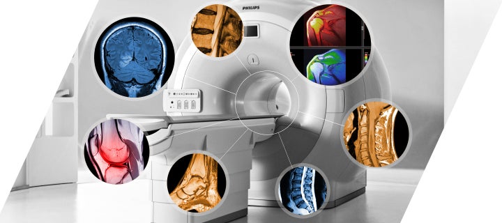 Hand and Wrist MRI | I-MED Radiology Network