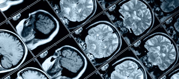 InteleViewer upgrade | I-MED Radiology Network