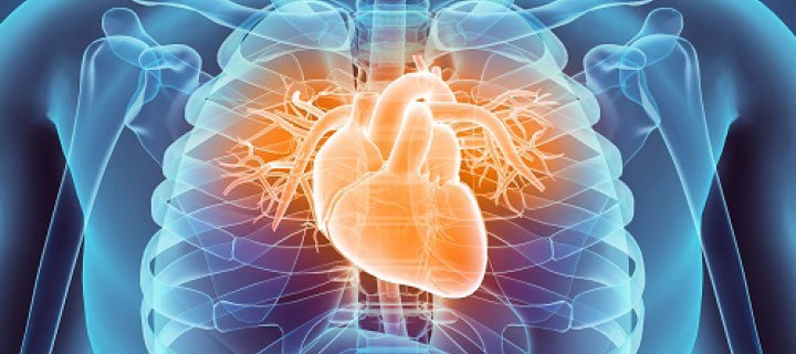Coronary artery calcium scoring for practitioners | I-MED Radiology Network