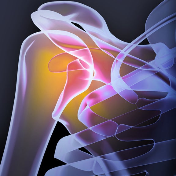 Musculoskeletal (MSK) imaging | I-MED Radiology Network