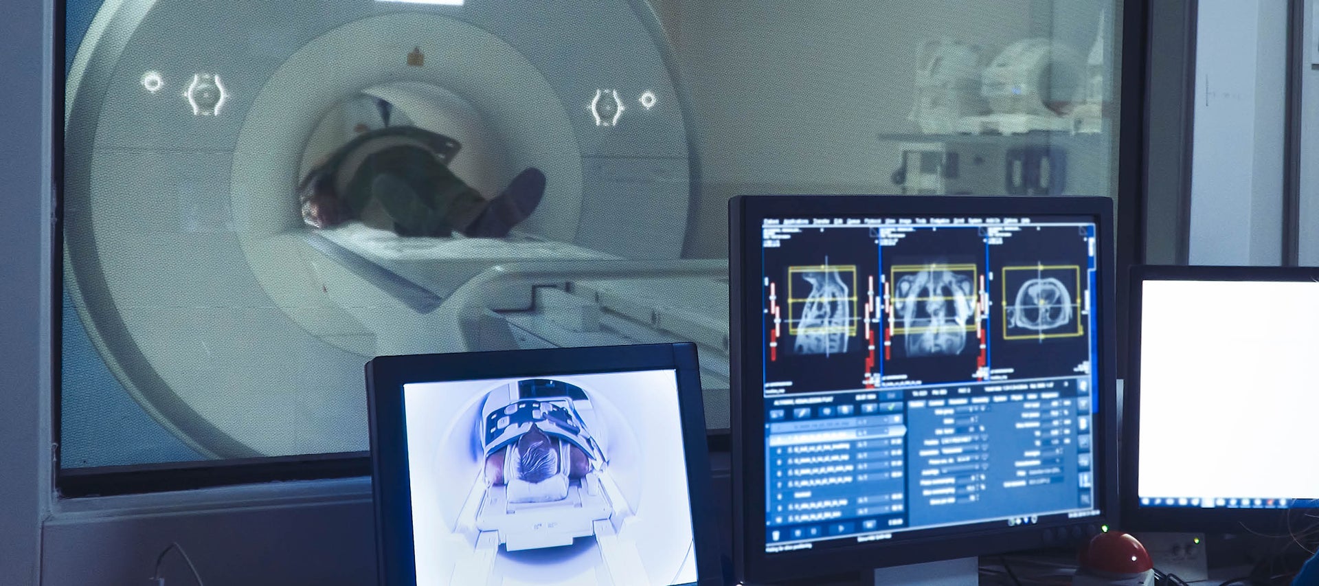 Magnetic resonance imaging (MRI) at I-MED | I-MED Radiology Network