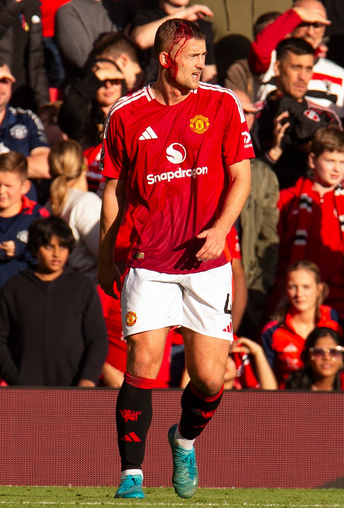Manchester United: Why Was Matthijs De Ligt’s Face Covered in Blood ...