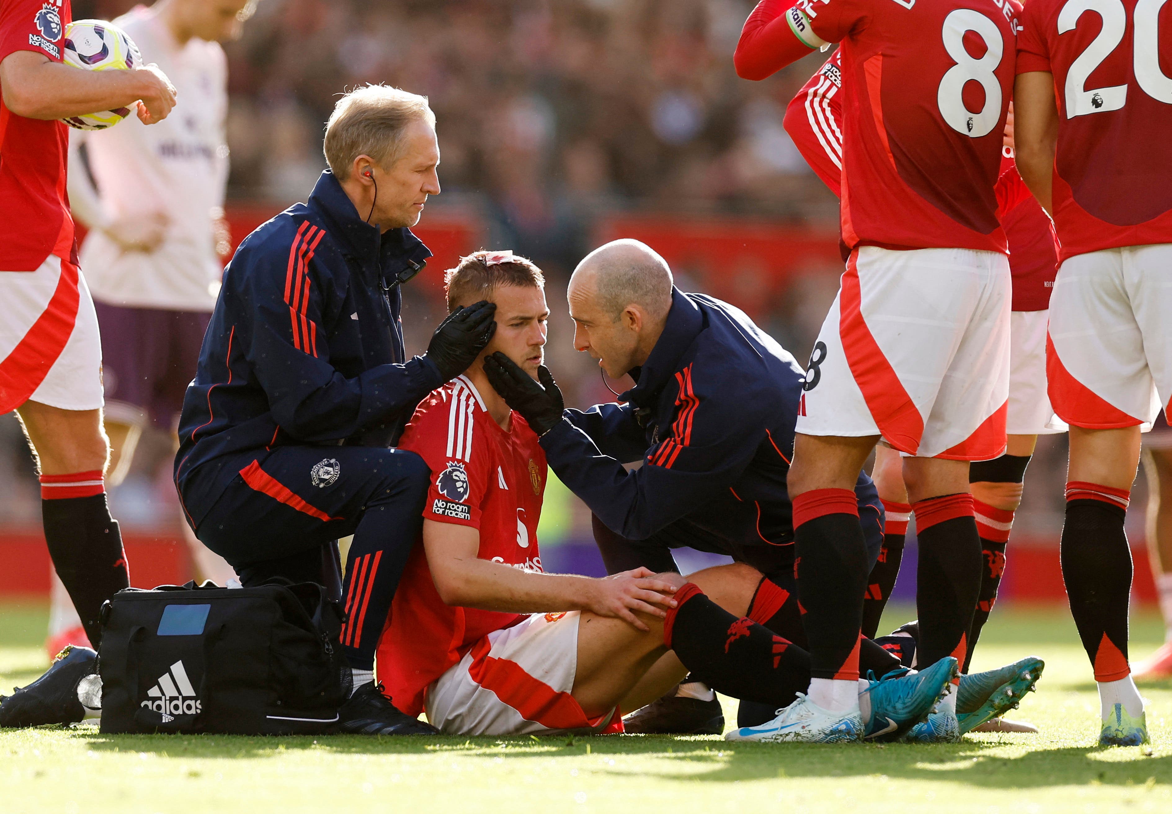 (PHOTOS) Matthijs De Ligt's Bloody Injury | beIN SPORTS