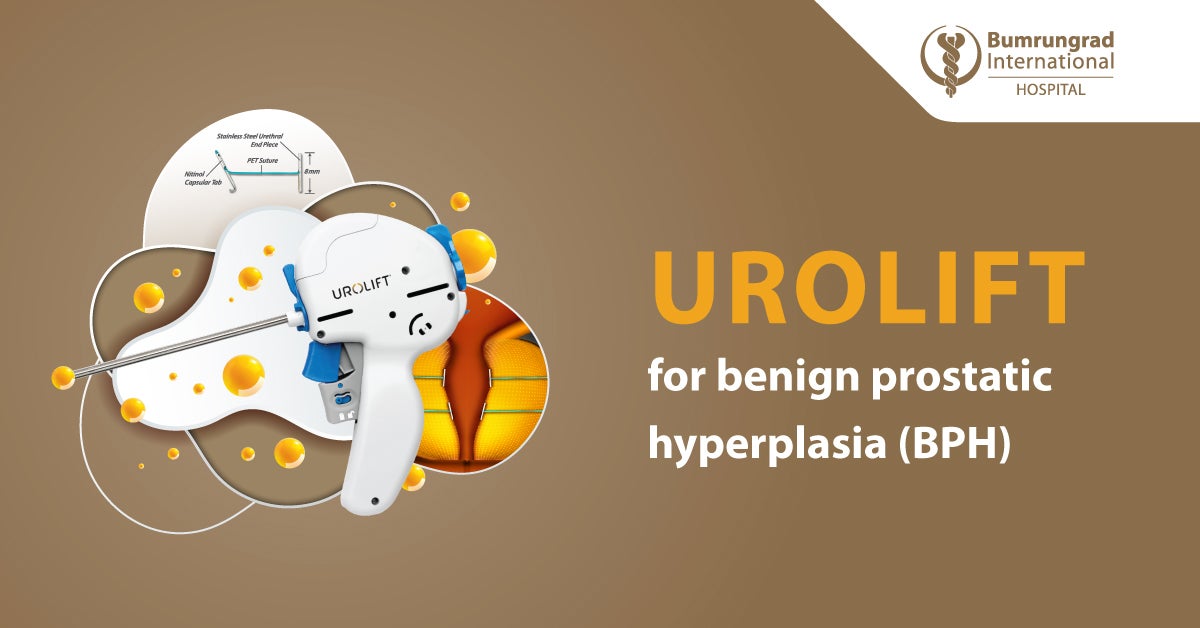 Urolift for benign prostatic hyperplasia (BPH)