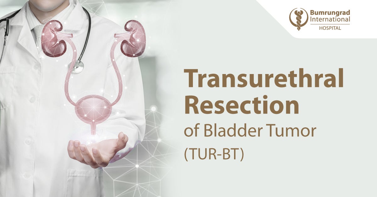 Transurethral resection of a bladder tumor (TURBT) under general anesthesia