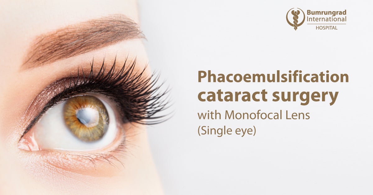 Phacoemulsification Single Eye with Monofocal Lens for ...