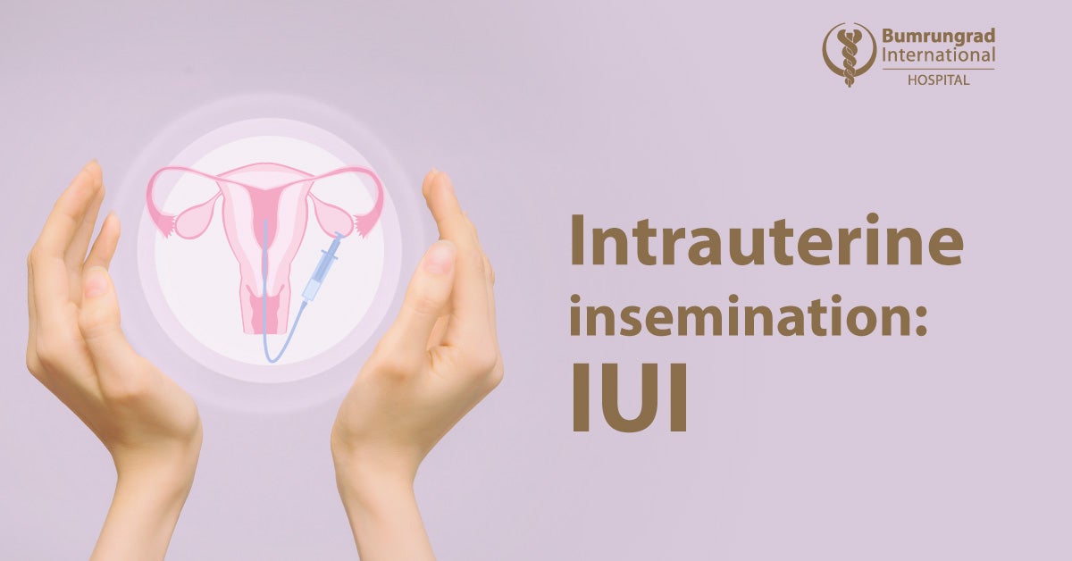 Intrauterine insemination:IUI