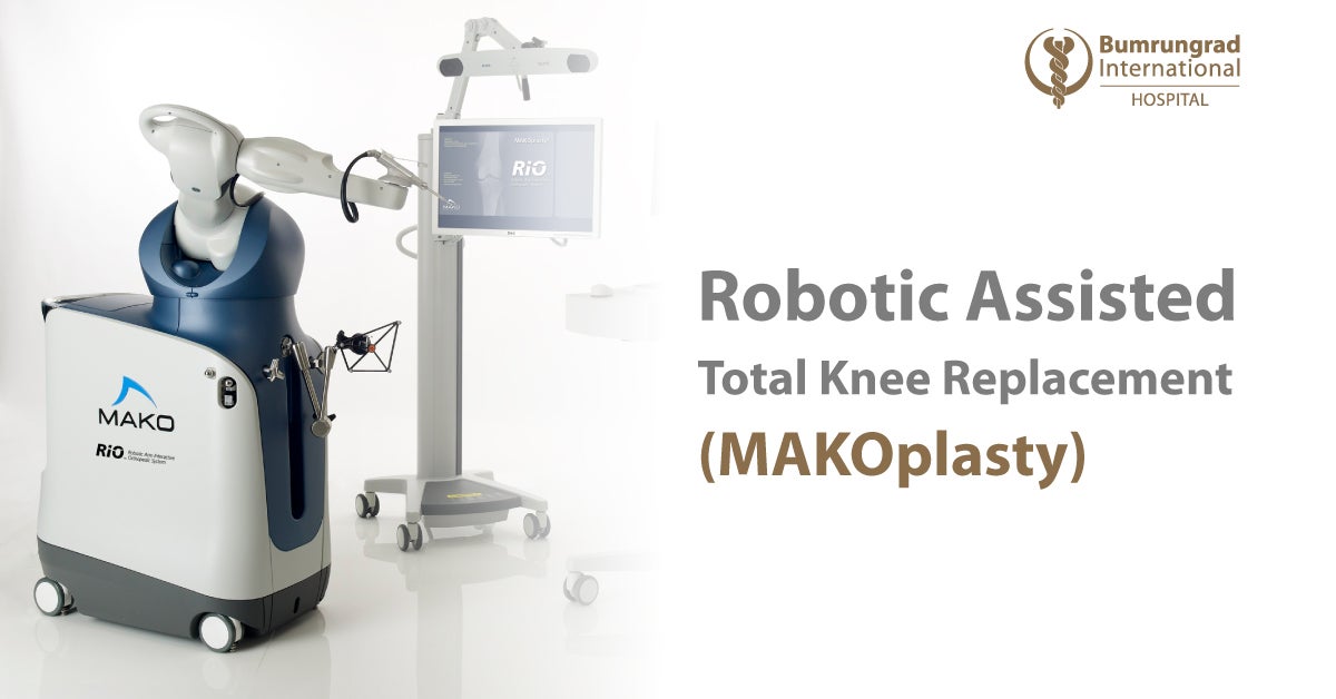 Robotic Assisted Total Knee Replacement (MAKOplasty)