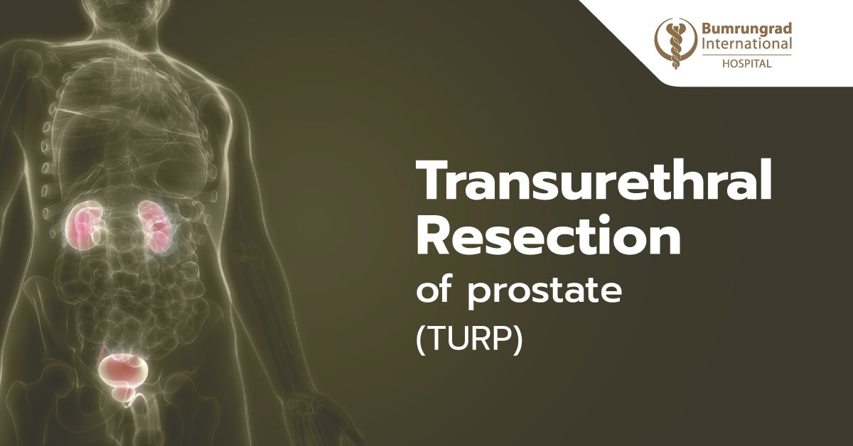 Transurethral resection of the prostate (TURP) under general anesthesia