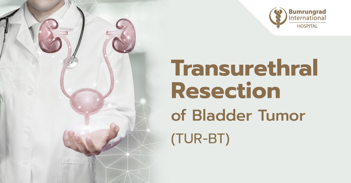 Transurethral resection of a bladder tumor (TURBT) under general anesthesia