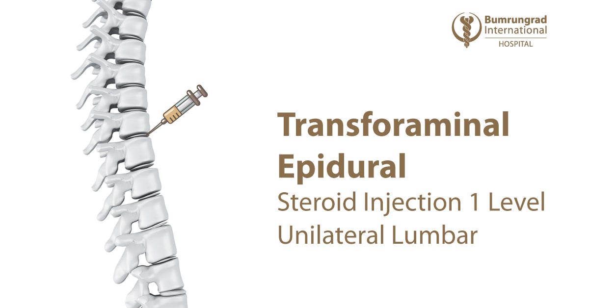 Transforaminal Epidural steroid injection 1 level unilateral_Lumbar
