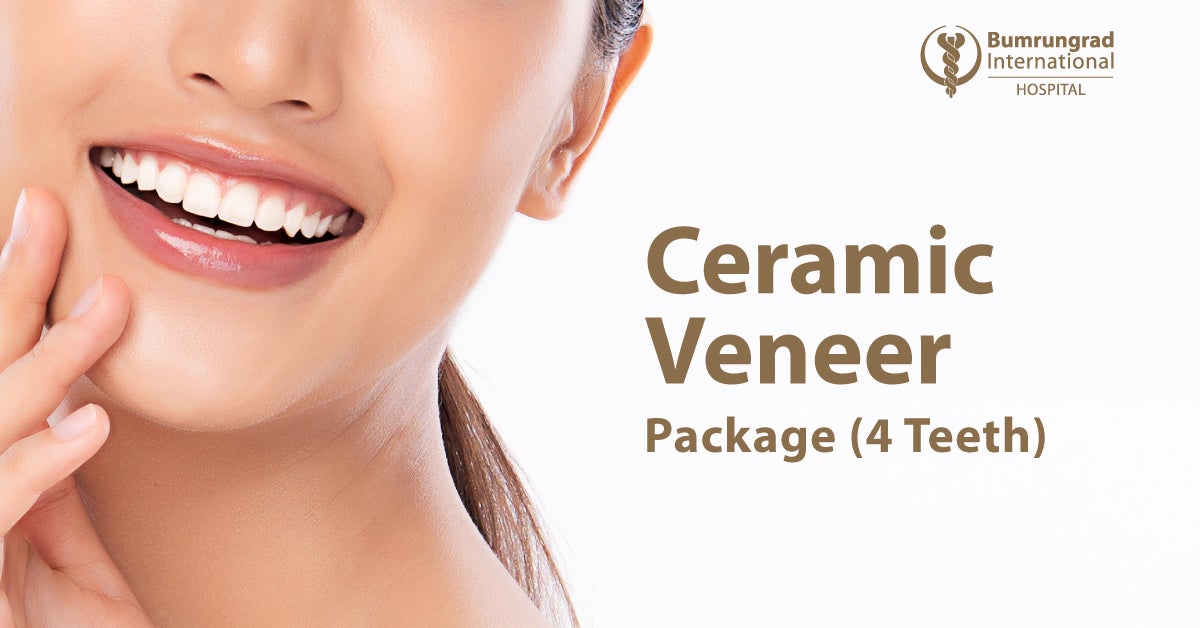 Ceramic Veneer package (4 teeth)