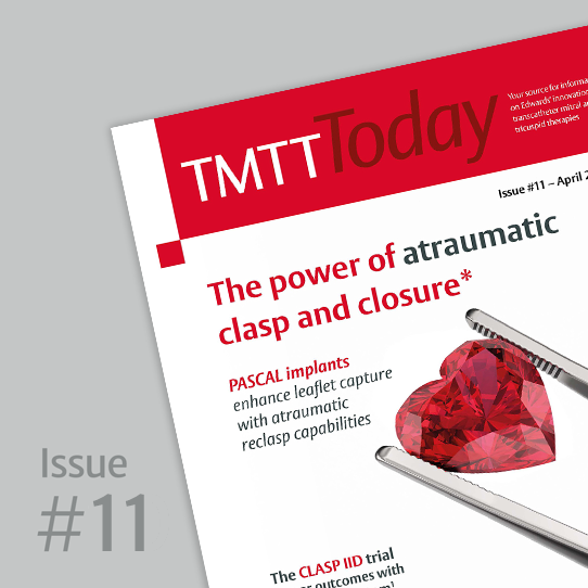 TMTT Today Magazine | Edwards Lifesciences