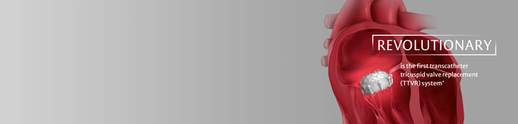EVOQUE Tricuspid Valve Replacement | Edwards Lifesciences