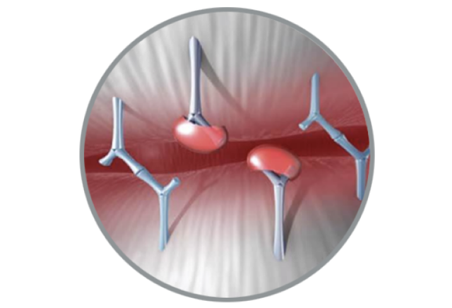 RESILIA tissue | Edwards Lifesciences