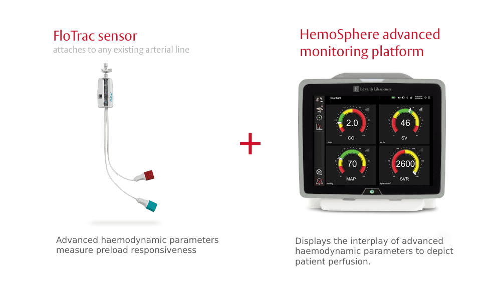 FloTrac Sensor | Edwards Lifesciences