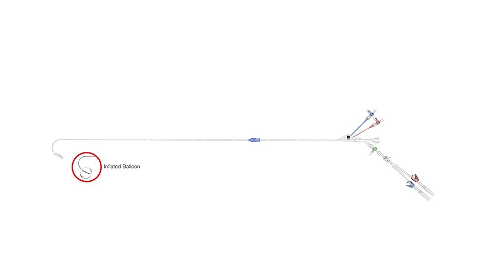 IntraClude Device | Edwards Lifesciences