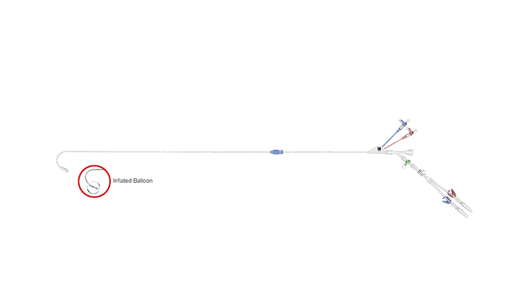 IntraClude Device | Edwards Lifesciences
