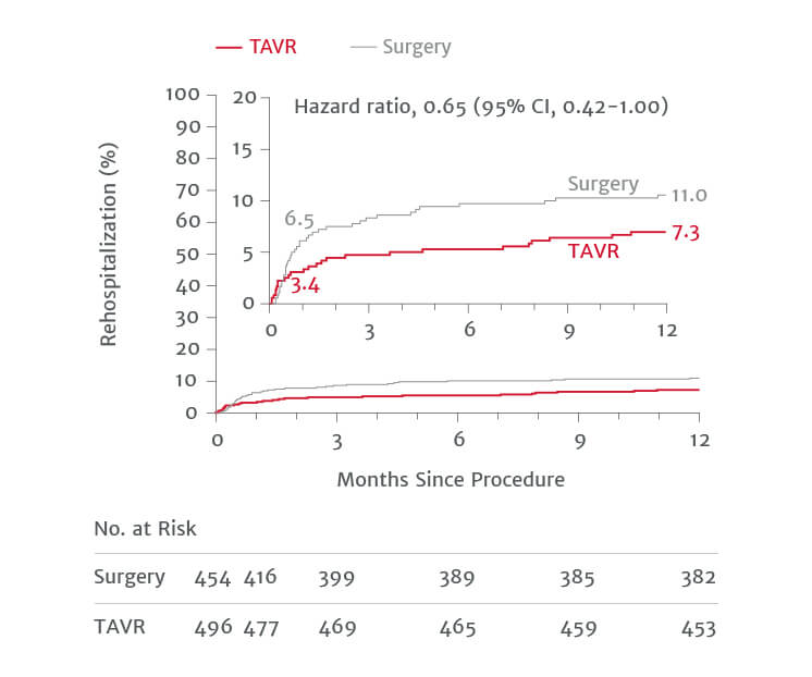 Transcatheter Aortic Valve Replacement | Edwards Lifesciences