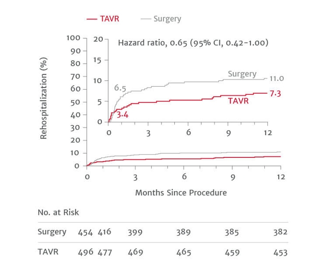 Transcatheter Aortic Valve Replacement | Edwards Lifesciences