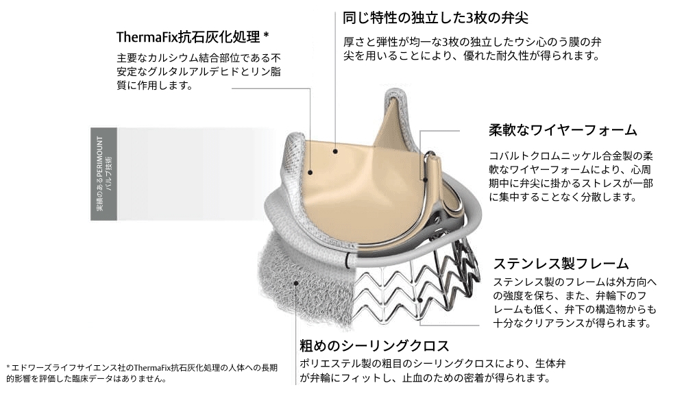 EDWARDS INTUITY Elite バルブシステム | Edwards Lifesciences