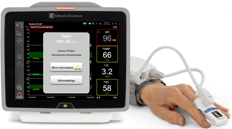 Acumen IQ cuff | Edwards Lifesciences