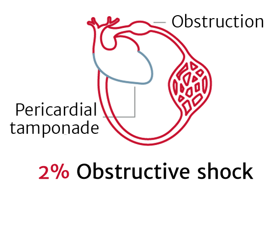 Shock Management | Edwards Lifesciences