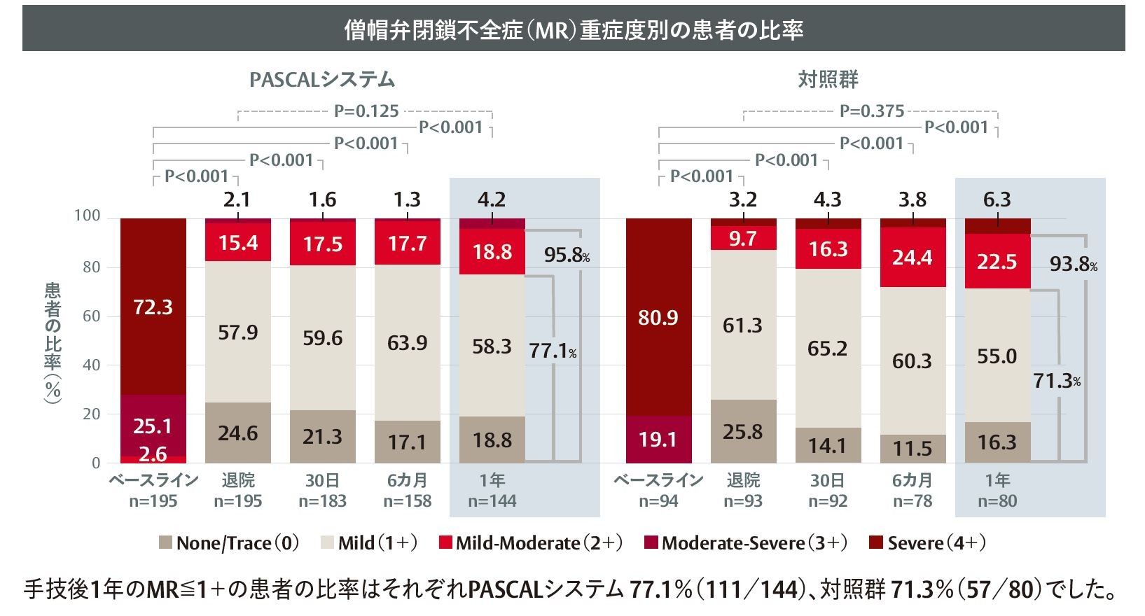PASCAL Precision システム | Edwards Lifesciences