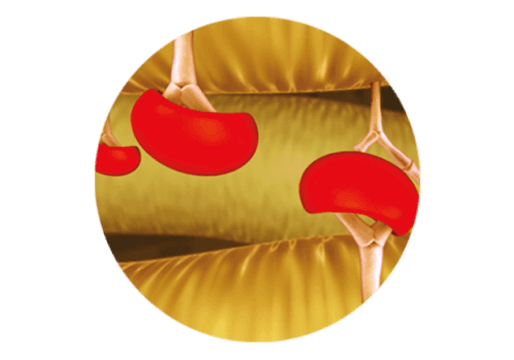 Transcatheter SAPIEN 3 Ultra RESILIA | Edwards Lifesciences