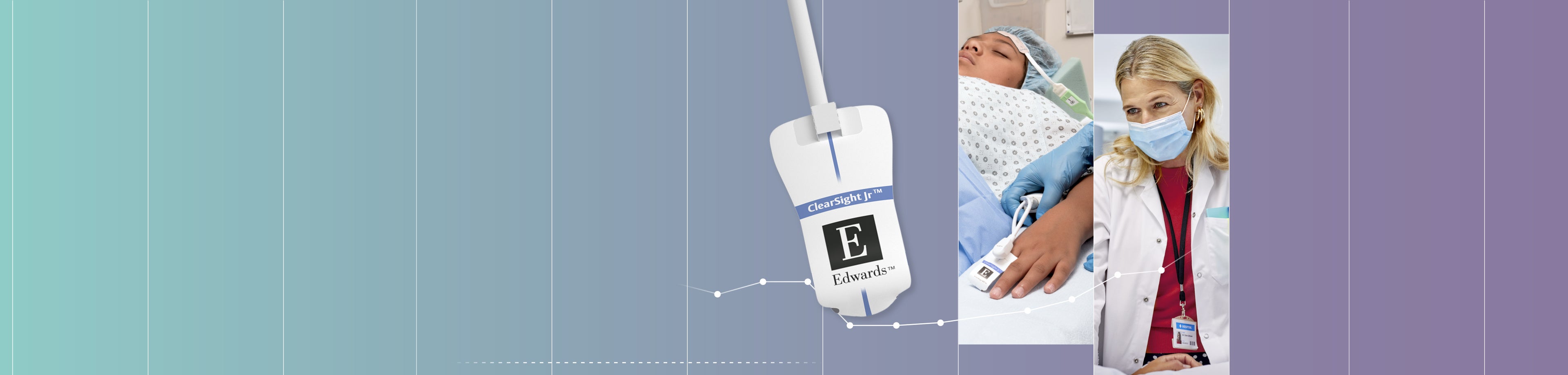 ClearSight Jr finger cuff | Edwards Lifesciences