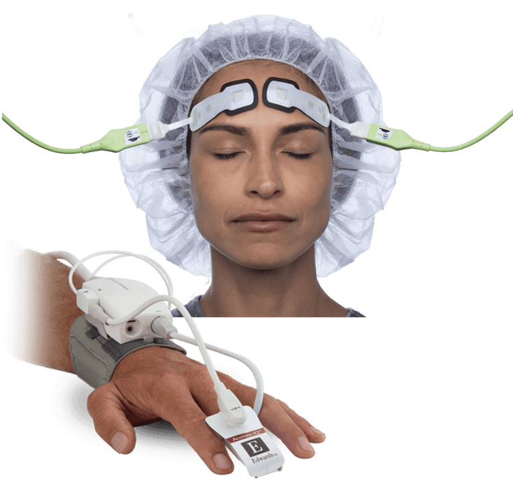 HemoSphere | Edwards Lifesciences