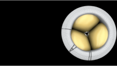 Durability & performance | Edwards Lifesciences