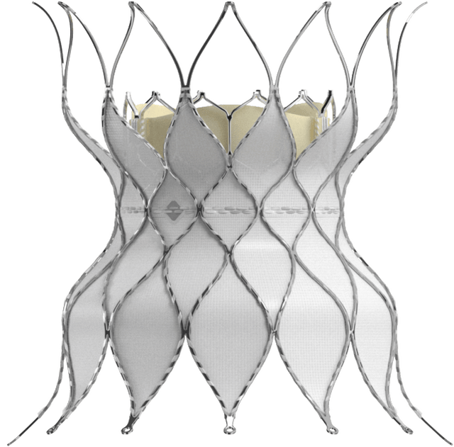 Transcatheter pulmonary valve replacement | Edwards Lifesciences
