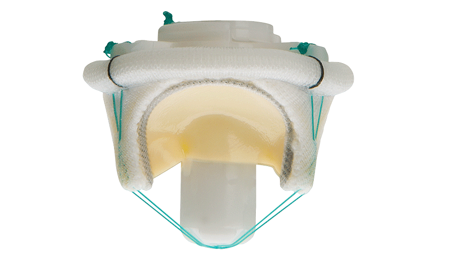 Mitral Pericardial Valve | Edwards Lifesciences