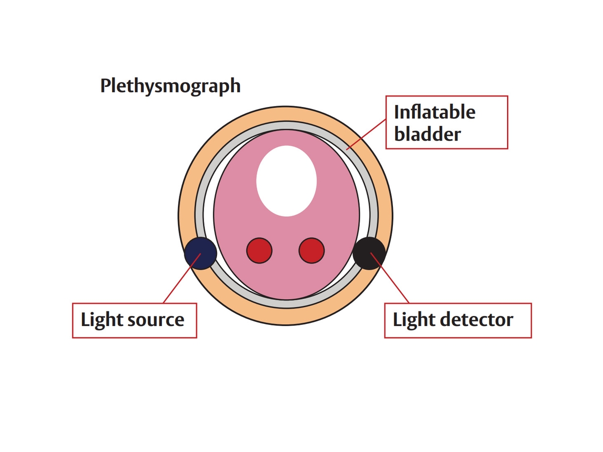 ClearSight system | Edwards Lifesciences