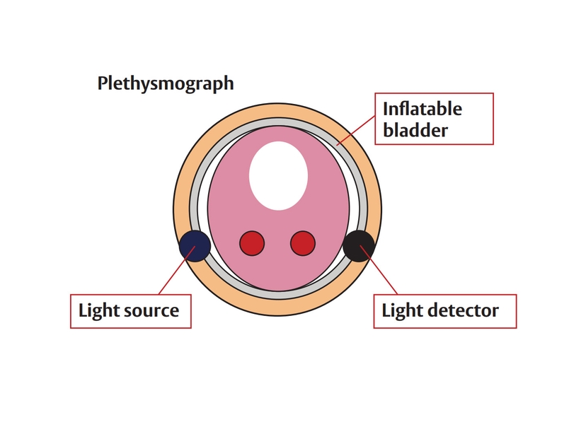 ClearSight system | Edwards Lifesciences