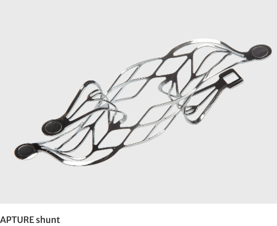 ALT-FLOW II Trial | Edwards Lifesciences