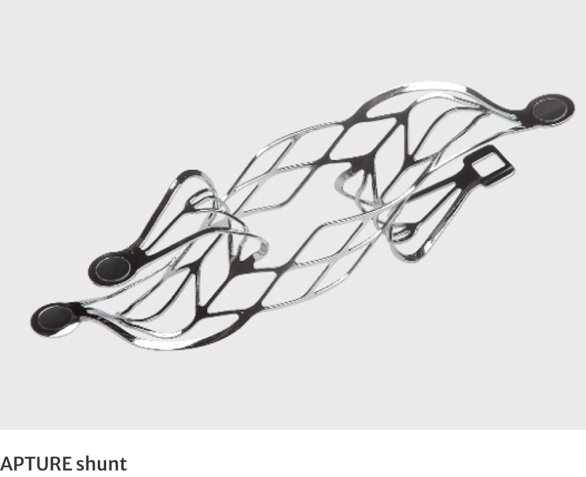 ALT-FLOW II Trial | Edwards Lifesciences