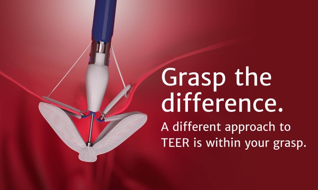 The PASCAL Precision system | Edwards Lifesciences