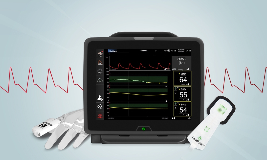 HemoSphere Vita monitor | Edwards Lifesciences