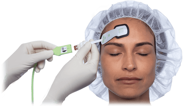 ForeSight Jr sensor | Edwards Lifesciences