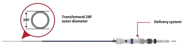 EVOQUE Tricuspid Valve Replacement | Edwards Lifesciences