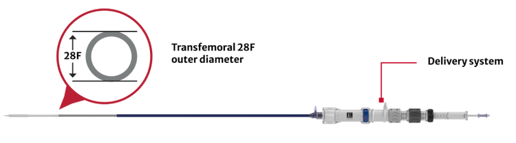 EVOQUE Tricuspid Valve Replacement | Edwards Lifesciences