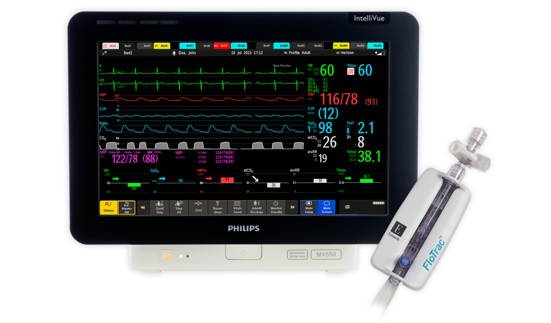 Philips Flotrac | Edwards Lifesciences